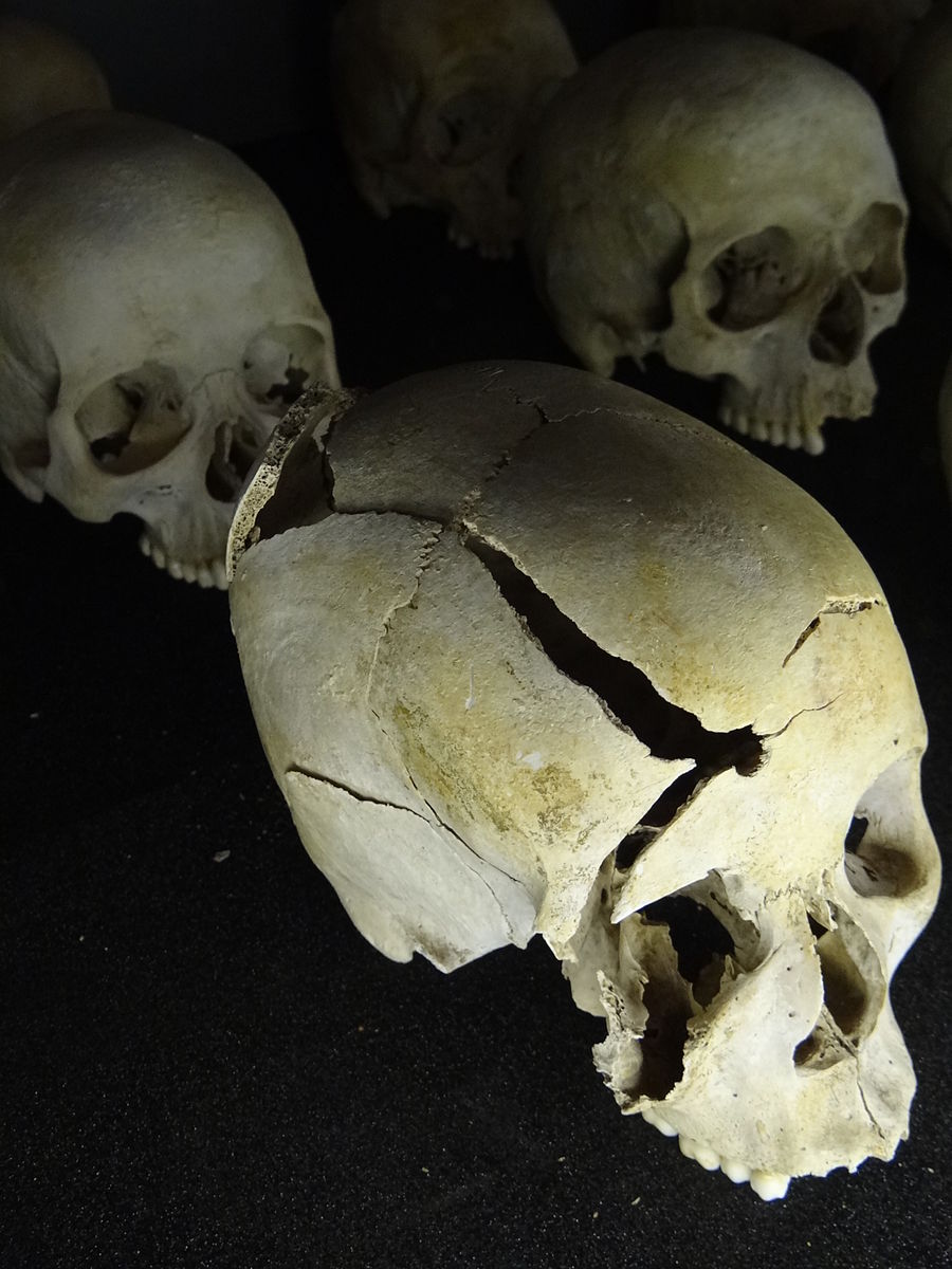 Skulls of Genocide Victims - Genocide Memorial Center - Kigali - Rwanda ...
